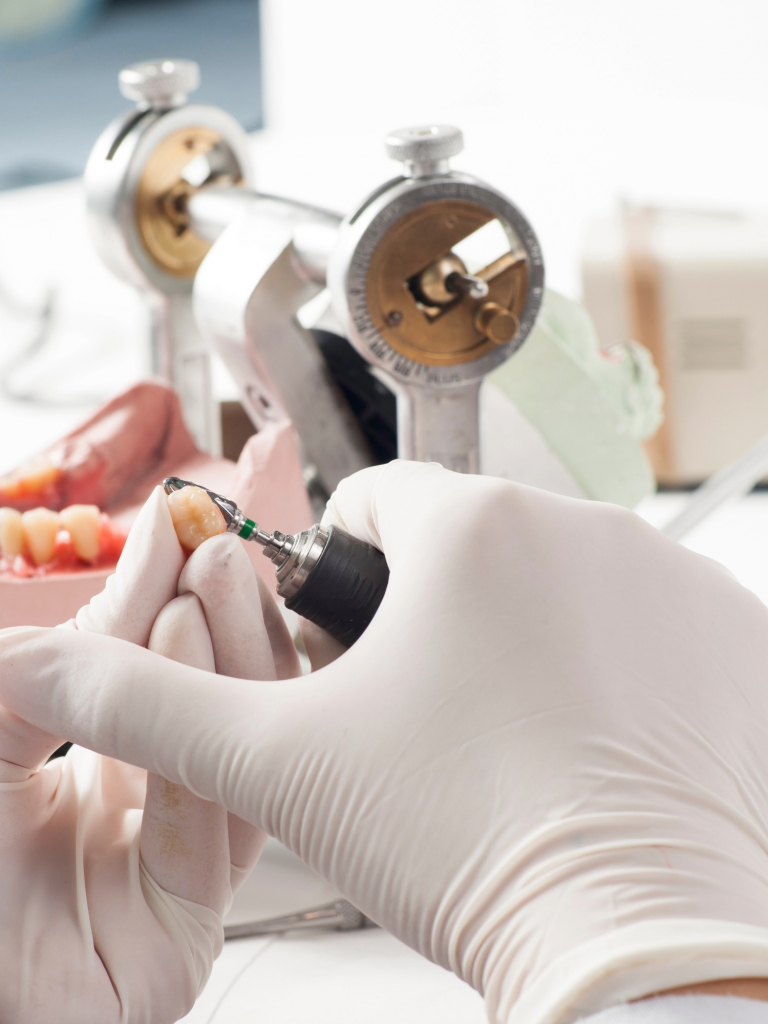 Dental Lab Services | KC Dental Lab Offerings